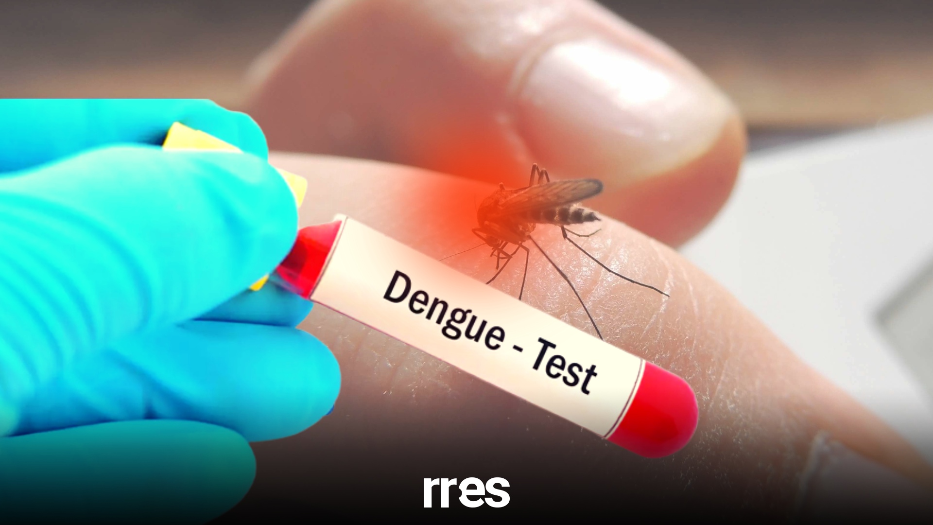 Expertos llaman a mantener vigilancia del dengue en Venezuela - Runrun ...